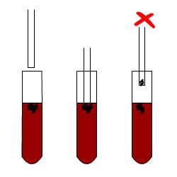 Automated Sample Preparation